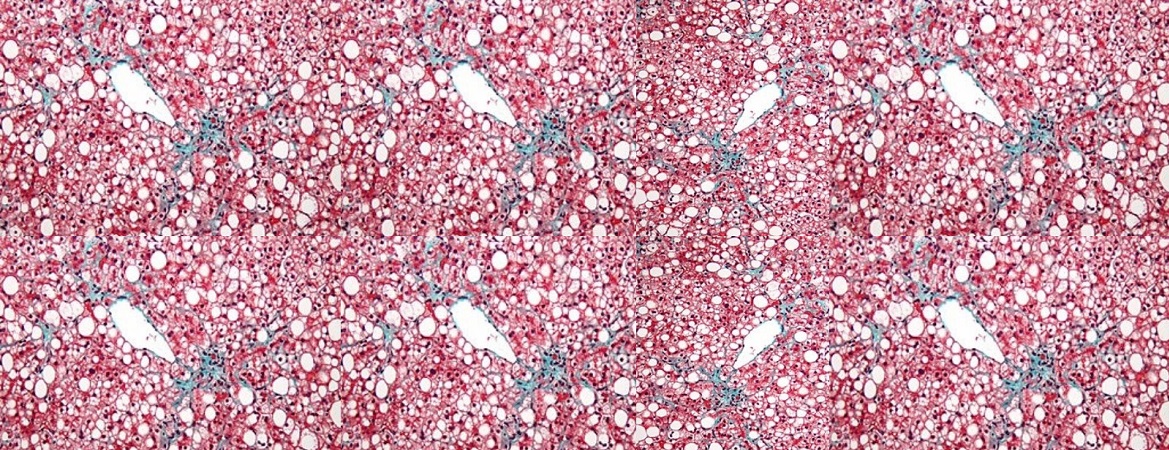 Galaxy - University of Southern Denmark, SDU