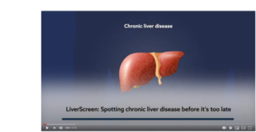 Screening af 25.000 europæere for leversygdom - SDU