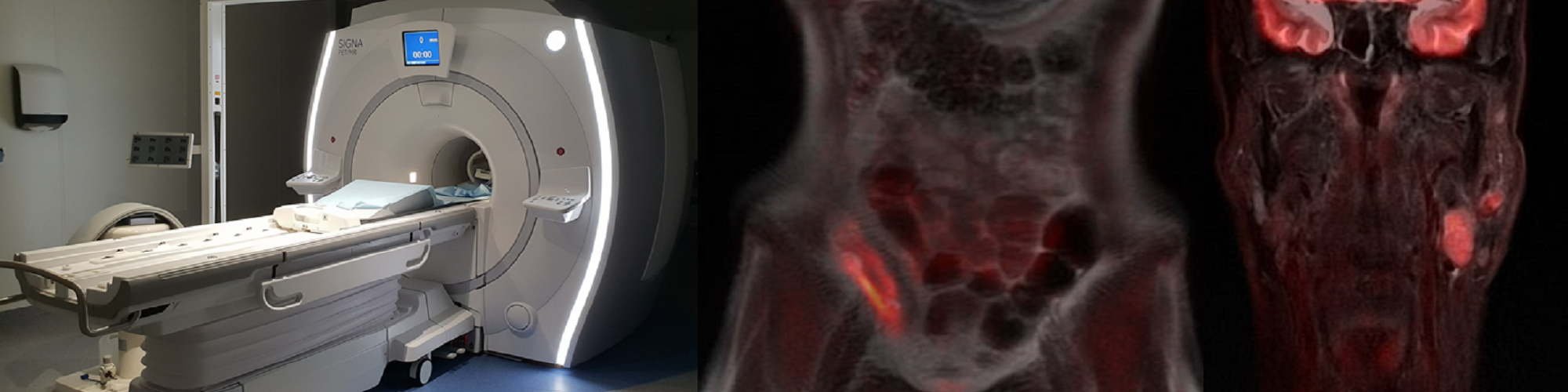 Forskningsenhed for Klinisk fysiologi og nuklearmedicin